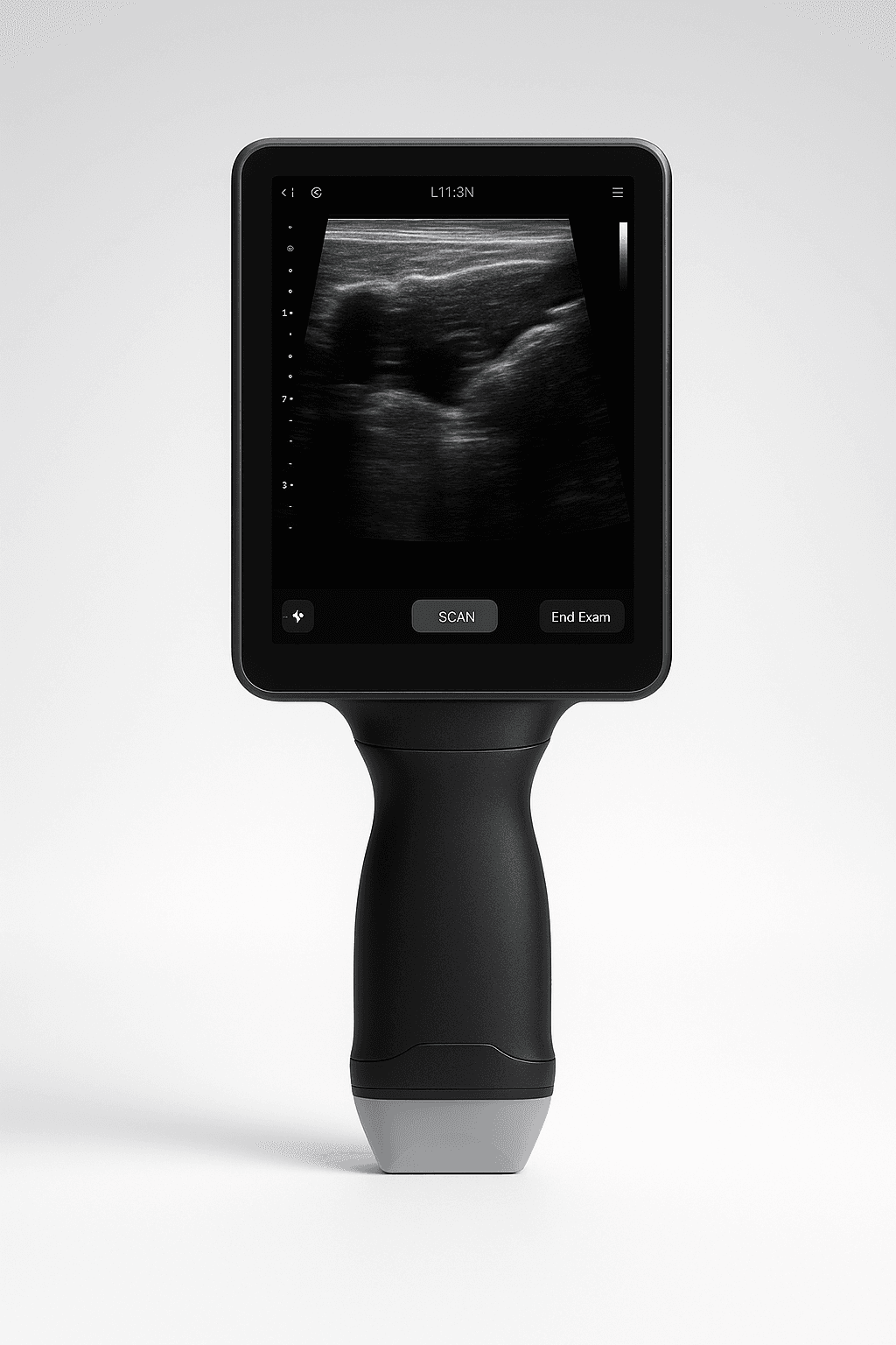 Review Lengkap TE Air Ultrasound - Distributor USG Mindray Resmi